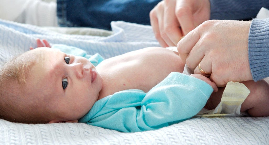 What To Do When Umbilical Cord Of Newborns Falls Off theblesssedmom What To Do When Umbilical Cord Of Newborns Falls Off theblesssedmom